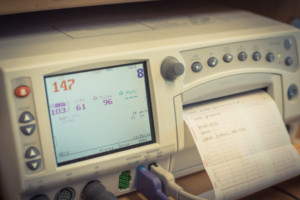 Top 5 At-Home Fetal Monitoring Devices For Mothers