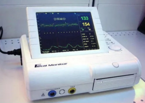 10 Best Fetal Monitoring Devices For Hospitals & Clinics In India