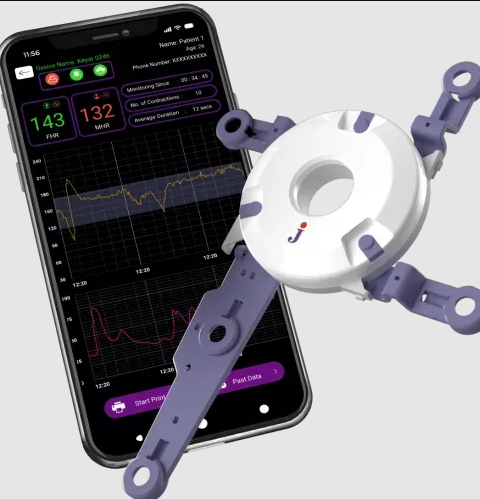 10 Best Fetal Monitoring Devices For Hospitals & Clinics In India