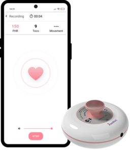 Top 5 At-Home Fetal Monitoring Devices For Mothers