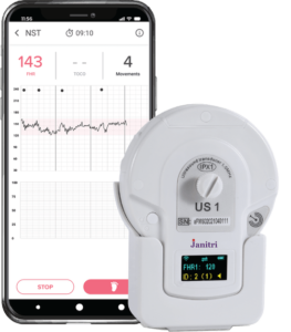 Top 5 At-Home Fetal Monitoring Devices For Mothers